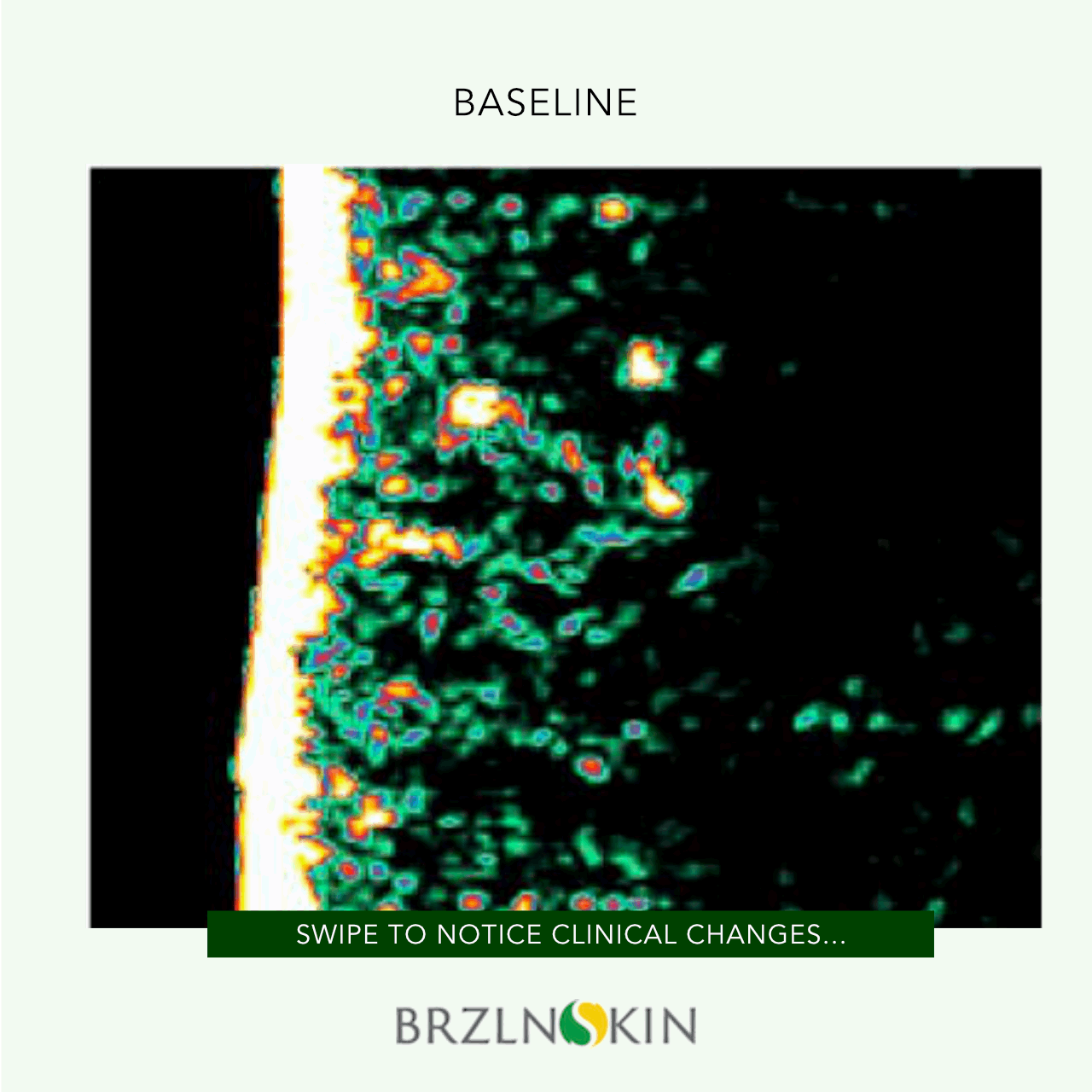 brazilianfacelift kit - A clinically-tested, revolutionary kit contain ...