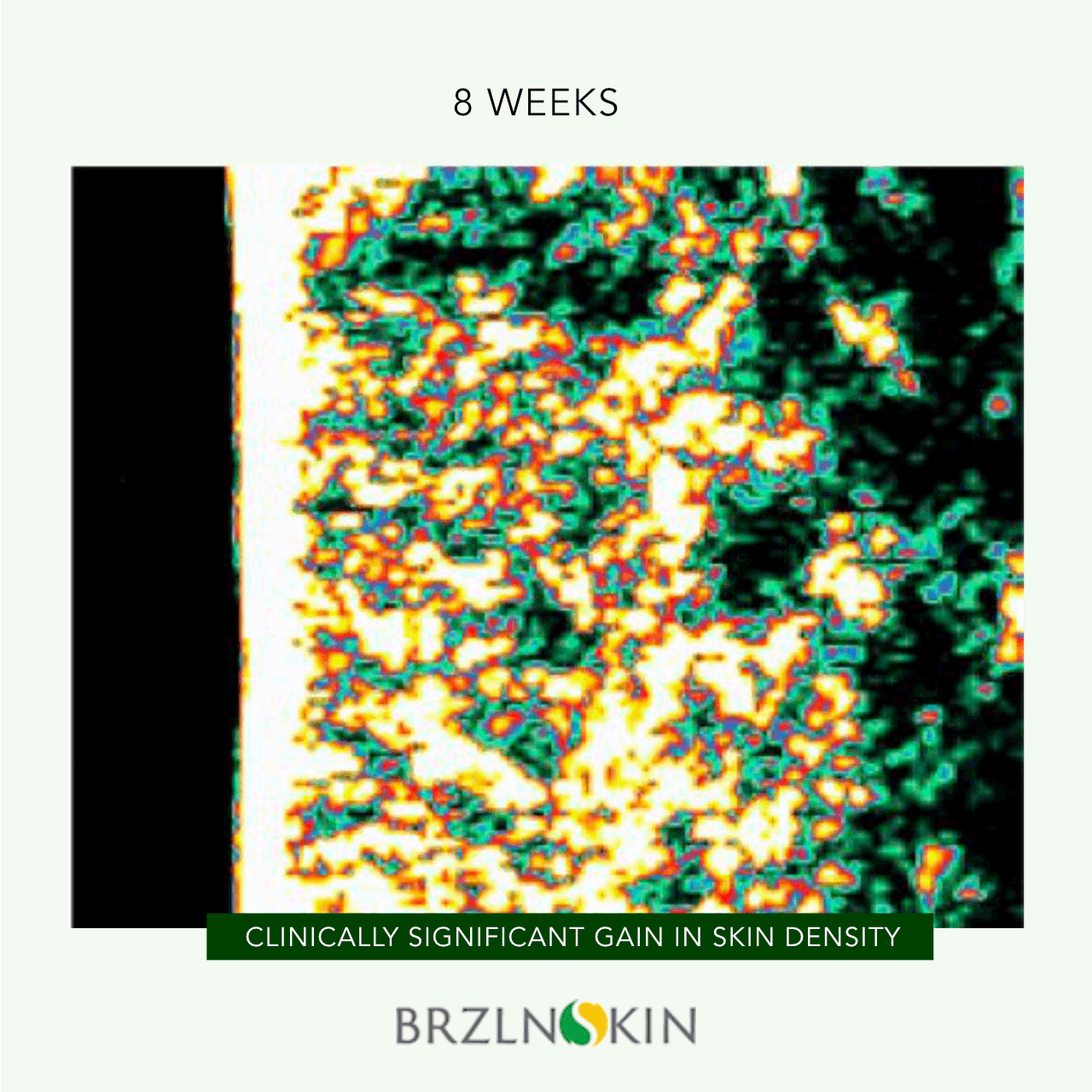 brazilianfacelift kit - A clinically-tested, revolutionary kit contain ...