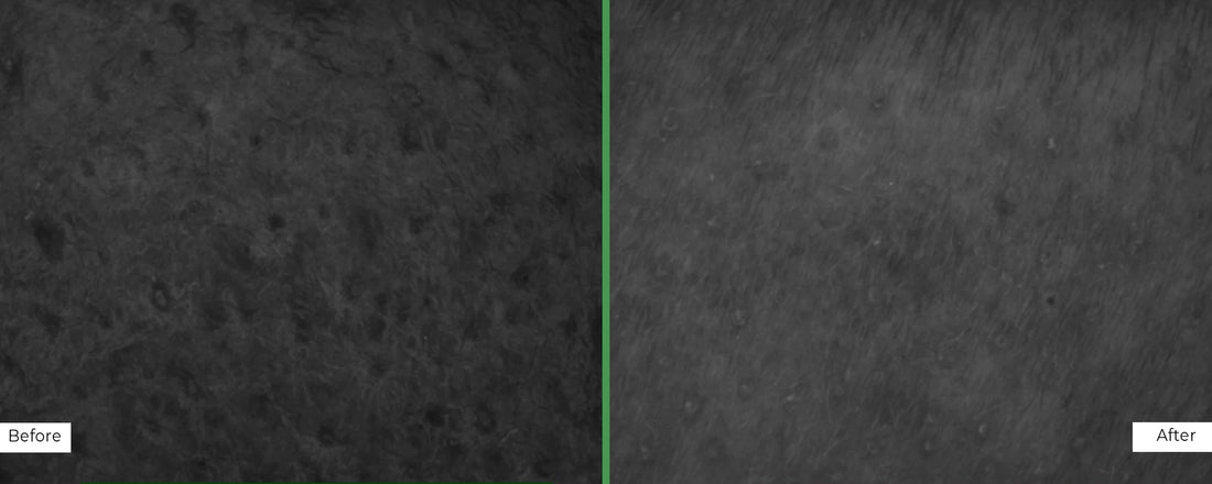 brazilianfacelift kit - A clinically-tested, revolutionary kit contain ...